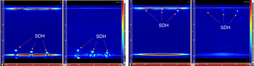 The Pros and Cons of Phase Coherence Imaging (PCI)
